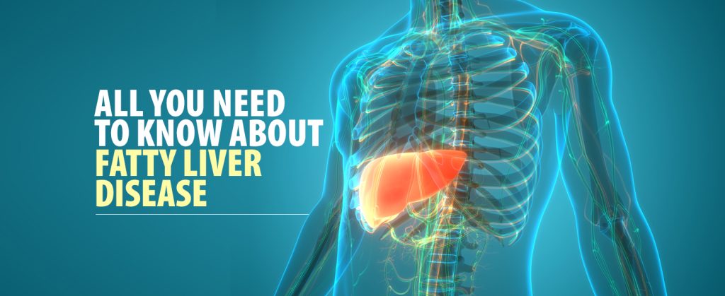 All you need to know about Fatty Liver disease - Kokilaben Hospital Blog