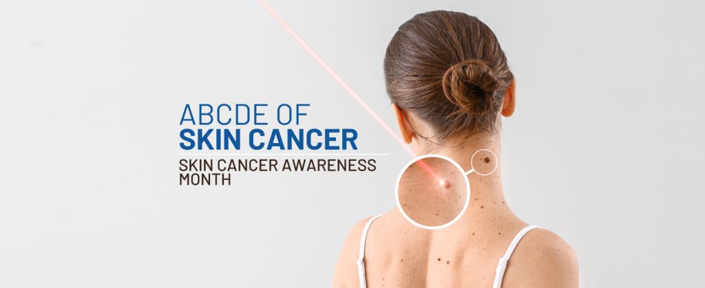 Skin Cancer Awareness and Precautions - Kokilaben Hospital Blog