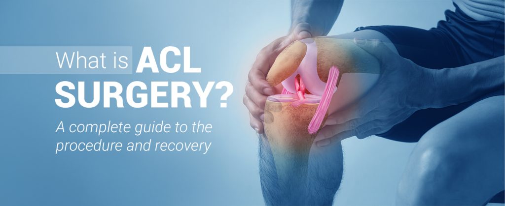 What is ACL Surgery? A Complete Guide to the Procedure and Recovery